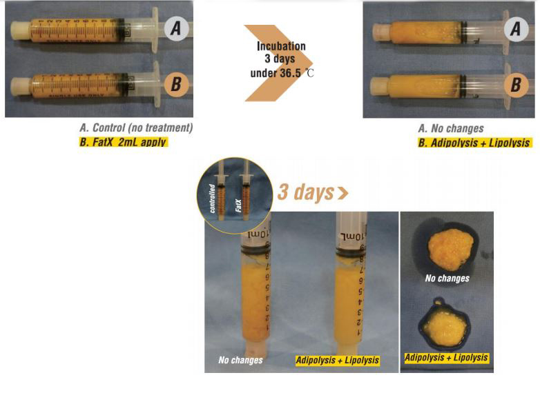 dermal filler injections , non surgical fat removal in india, non ...